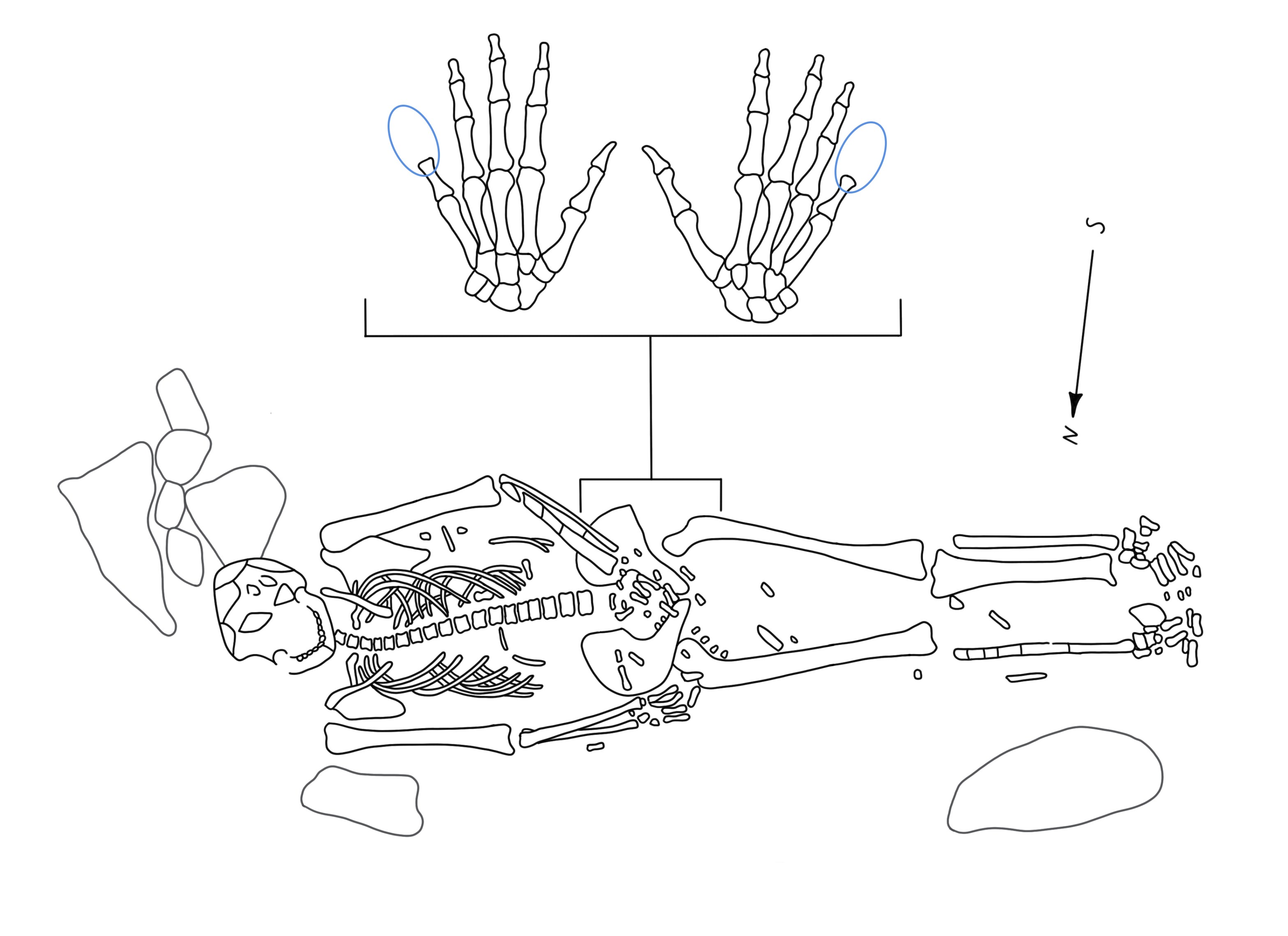 Blog Post #98: Cultural Finger Amputation with Brea McCauley – Peopling ...